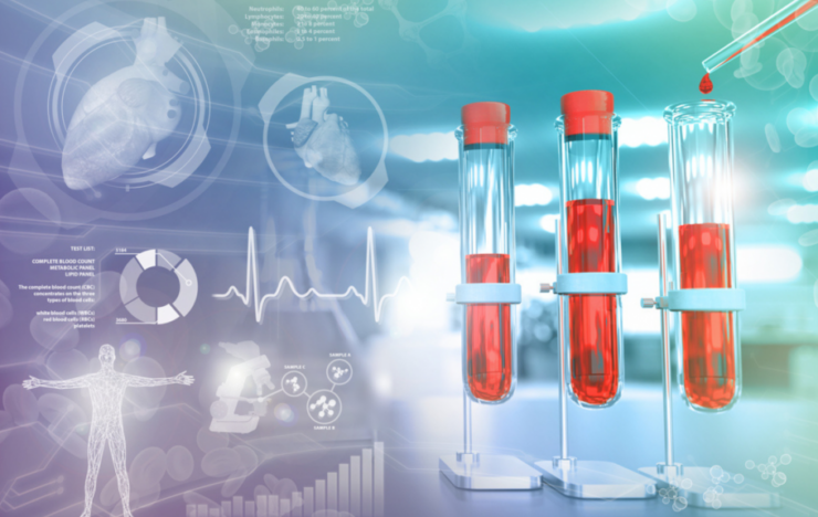 Na šta ukazuju povišeni monociti u krvi: Razumevanje uzroka i značaja ...