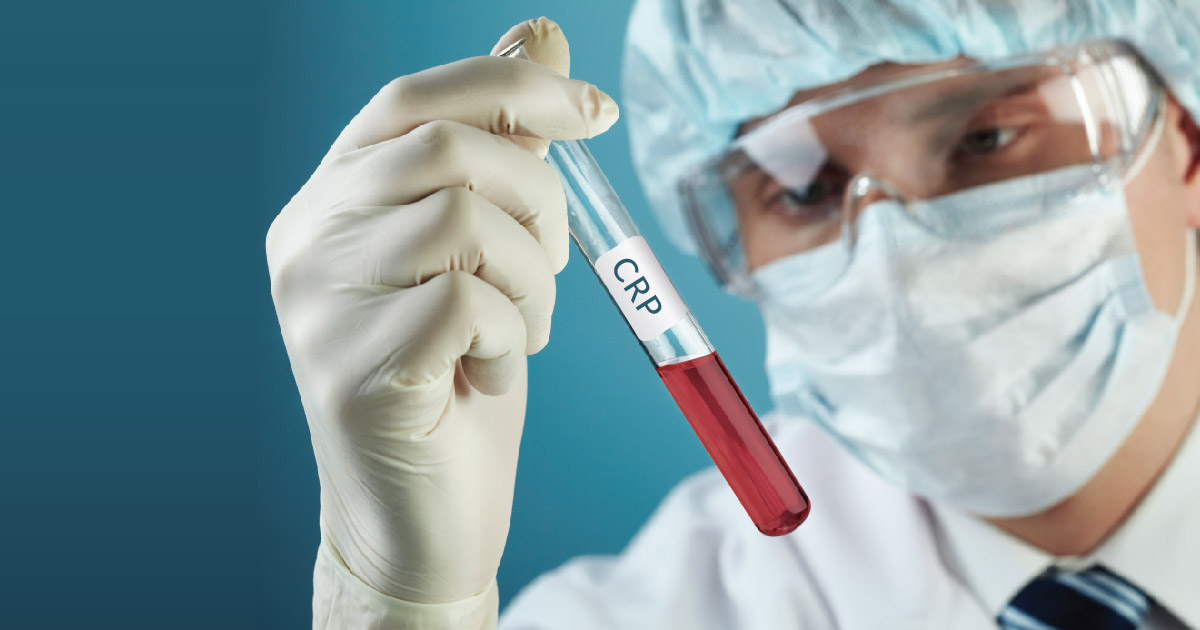 Na šta ukazuju povišeni monociti u krvi: Razumevanje uzroka i značaja - Sens