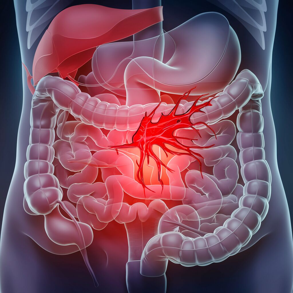 Slepo crevo: Simptomi upale i lokacija